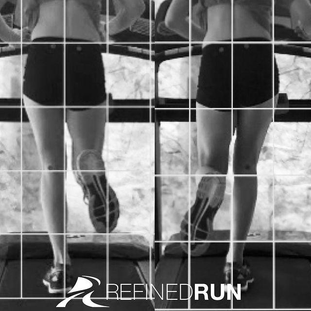 How to Treat and Get Rid of IT Band Pain for Good! | Refining Your ...